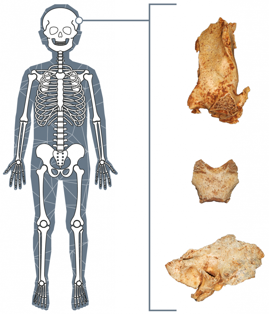 Paleopathology | BIOMUSE